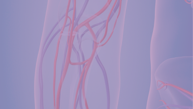 Management Pathway for insertion of PIVC