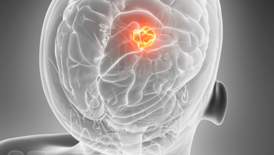 Understanding Cancer: Basic cell biology of cancer cells
